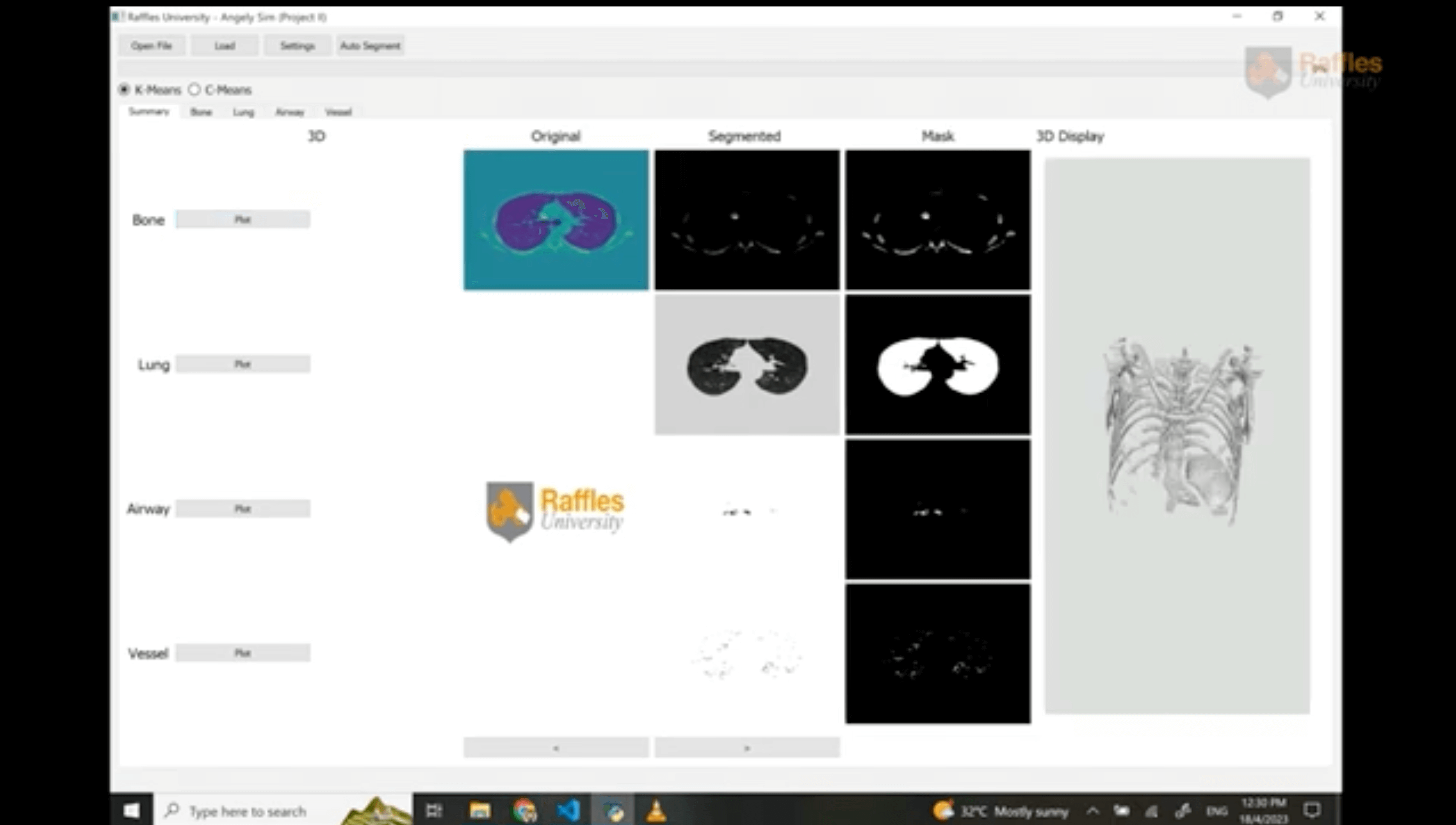 Artificial Intelligence Portfolio | CT Image Segmentation - Raffles ...